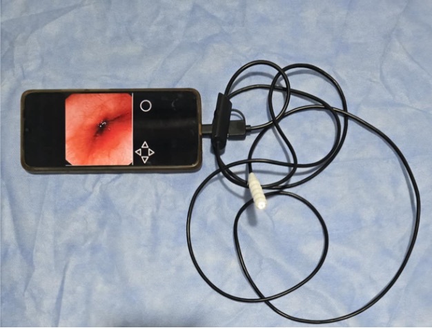 WormScope | Scientific Endoscopy Revolution